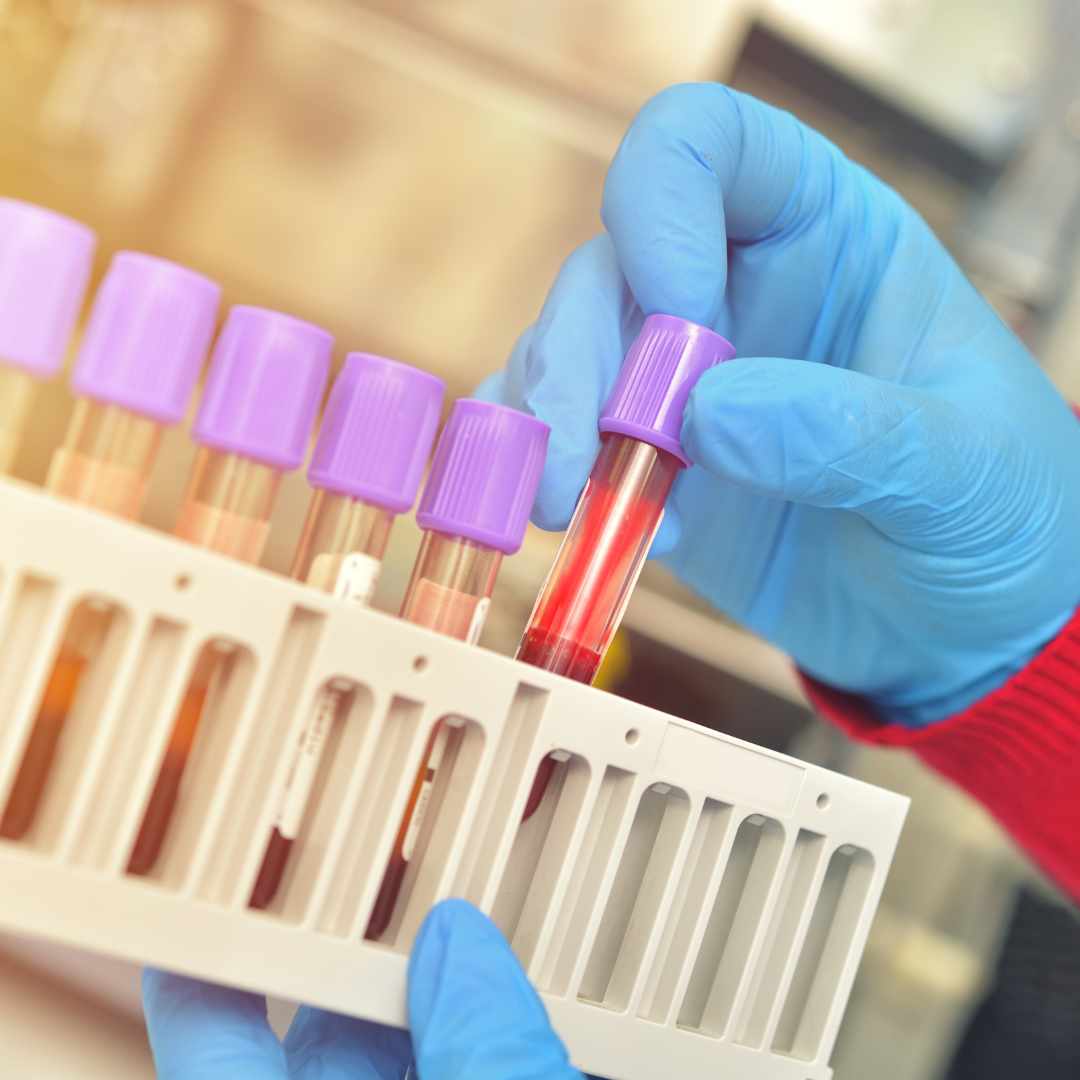 Hematologia e Hemoterapia | Clínica Brasil